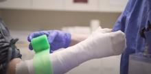 What to expect when you get a cast | St. Charles Health